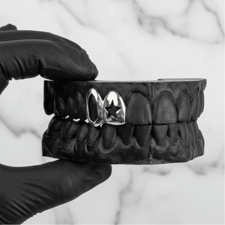 Custom Silver Star Grillz - Gold & Diamond Options HC Grillz